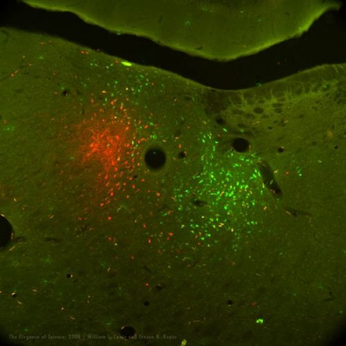 Labelling Patterns of Thalamocortical Connections in the Rat Brain ...