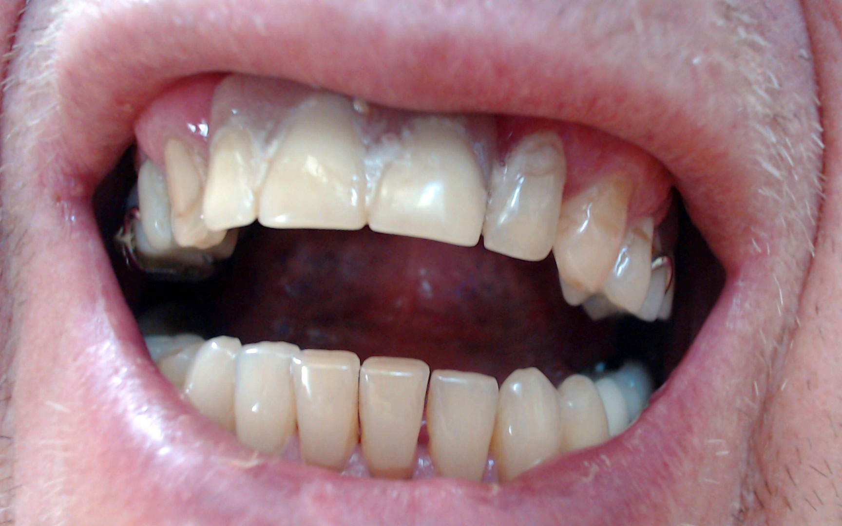 NYC Biting Injuries – International Shark Attack File